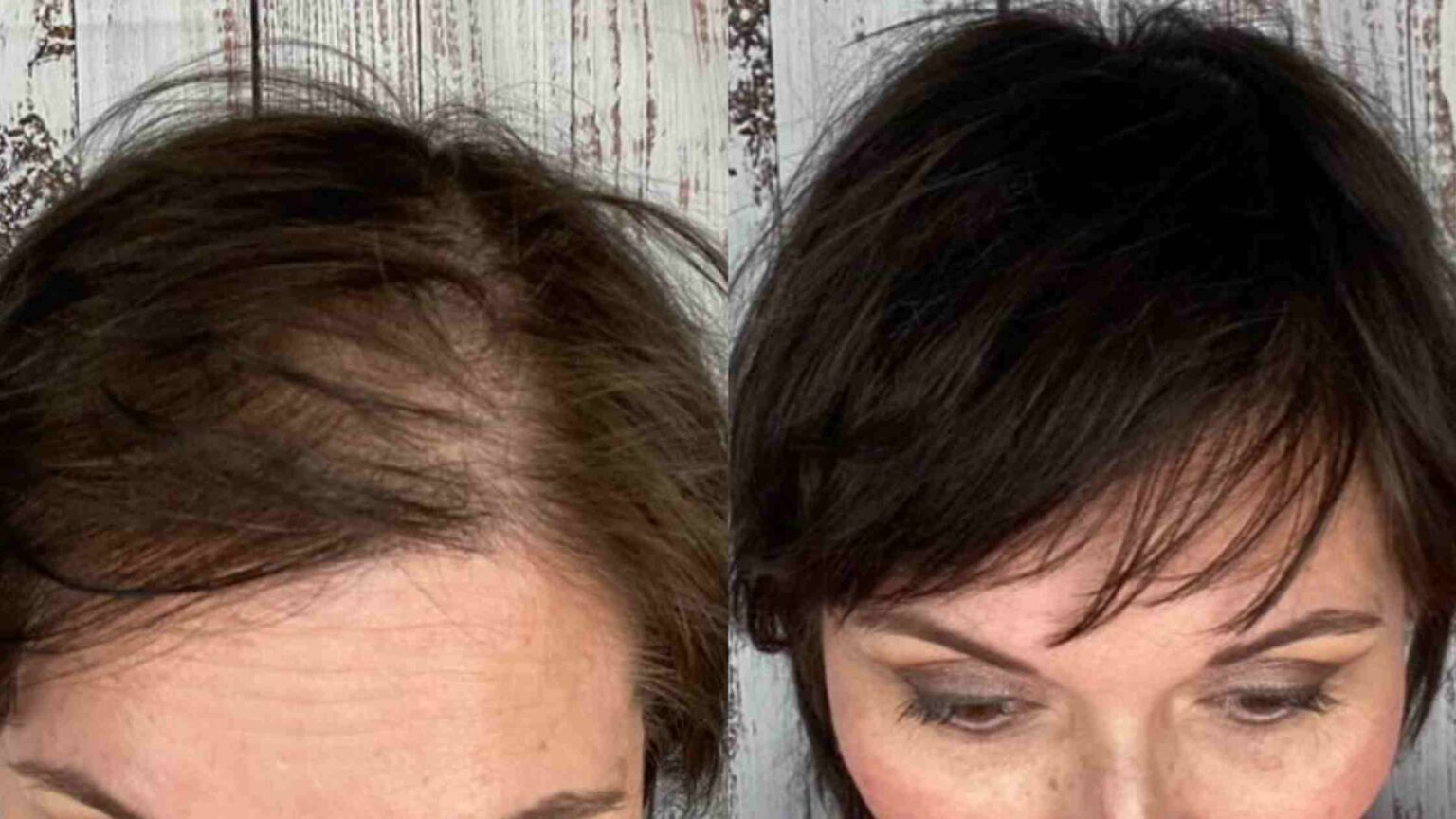 10 Best Hair Toppers for Short Hair for Instant Volume
